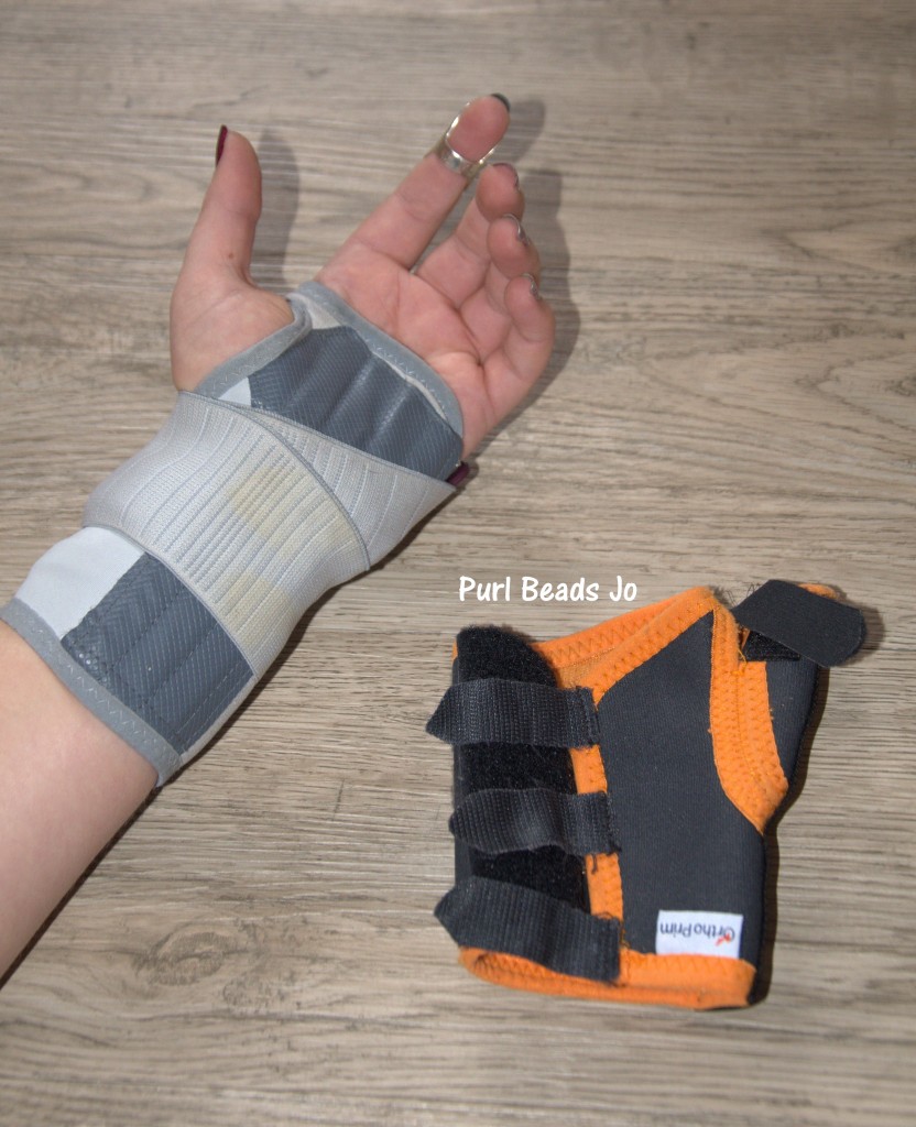 Using Splinting with Hypermobility Syndromes - Jo Southall, Independent OT